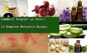 Comment Soigner La Gale : 12 Remèdes Maison Efficaces